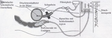 Funktionsdiagnostik / Urodynamik
